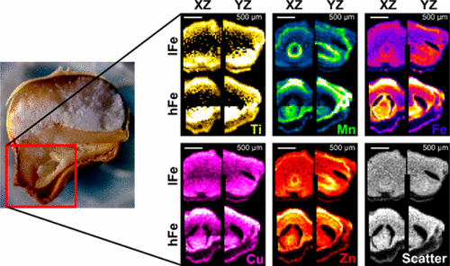 Advanced Absorption Correction for 3D Elemental Images Applied to the ...