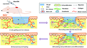 Injectable bioactive akermanite/alginate composite hydrogels for in ...