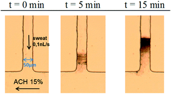 The mechanism of eccrine sweat pore plugging by aluminium salts using ...