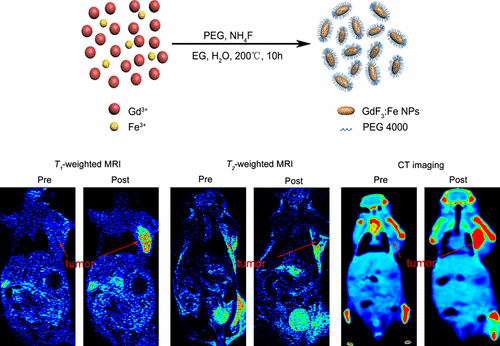 PEGylated GdF3:Fe Nanoparticles as Multimodal T1/T2-Weighted MRI and X ...