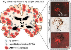 Aβ plaque-selective NIR fluorescence probe to differentiate Alzheimer's ...