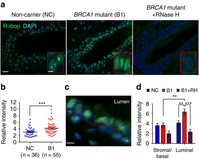 RNA 聚合酶 II 暂停的减弱可减轻 BRCA1 相关的 R 环积累和肿瘤发生。,Nature Communications - X-MOL