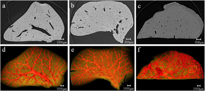 High-resolution 3D visualization of ductular proliferation of bile duct ...