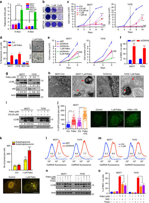 CDK4 / 6和自噬抑制剂在Rb阳性细胞质细胞周期蛋白E阴性癌症中协同诱导衰老。,Nature Communications - X-MOL