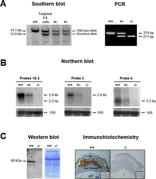 Maternal HtrA3 optimizes placental development to influence offspring ...