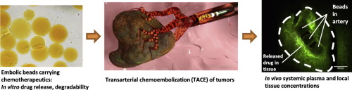 Drug-eluting embolic microspheres for local drug delivery – State of ...