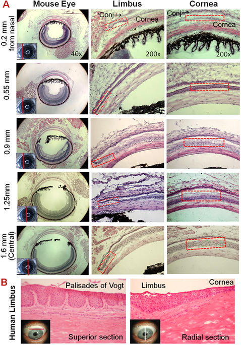 Identification for Differential Localization of Putative Corneal ...