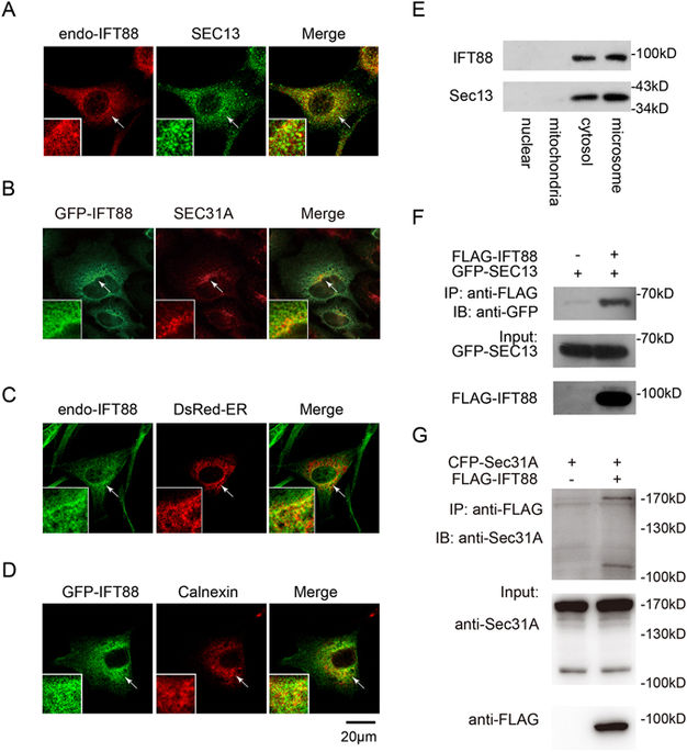 DGKδ triggers endoplasmic reticulum release of IFT88-containing ...