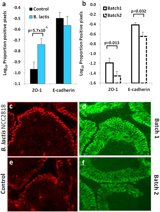 Early intervention with Bifidobacterium lactis NCC2818 modulates the ...