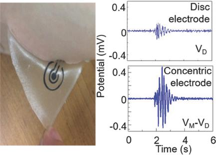 Stretchable Dry Electrodes with Concentric Ring Geometry for Enhancing ...