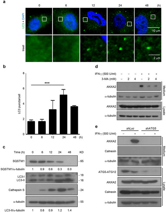 Exophagy of annexin A2 via RAB11, RAB8A and RAB27A in IFN-γ-stimulated ...