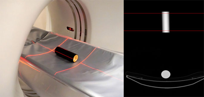 Validation of asynchronous quantitative bone densitometry of the spine ...