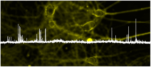 Voltage Imaging: Pitfalls and Potential,Biochemistry - X-MOL