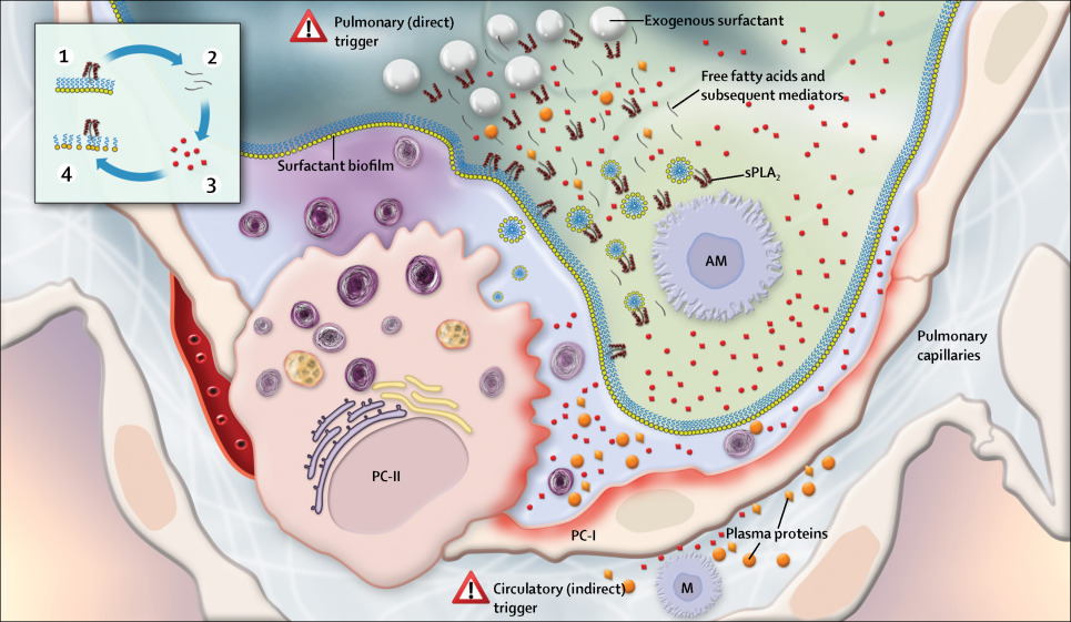 The Montreux definition of neonatal ARDS: biological and clinical ...