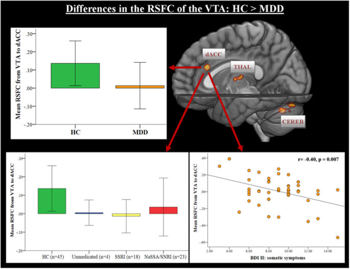 在重度抑郁症中，治疗相关的中脑/脑干核功能连接性改变。,Scientific Reports - X-MOL