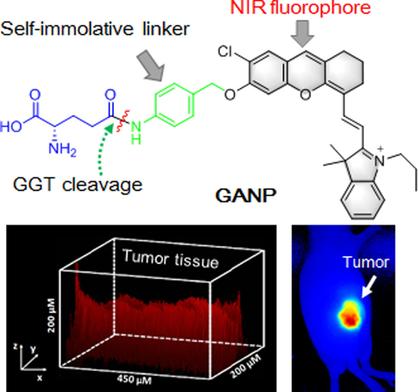 Activatable Near-Infrared Probe for Fluorescence Imaging of γ-Glutamyl Transpeptidase in Tumor ...