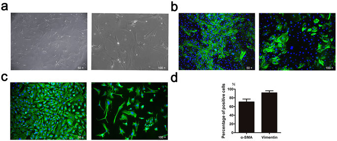 MicroRNA-449c-5p通过Smad4介导的途径抑制人VIC的成骨分化。,Scientific Reports - X-MOL