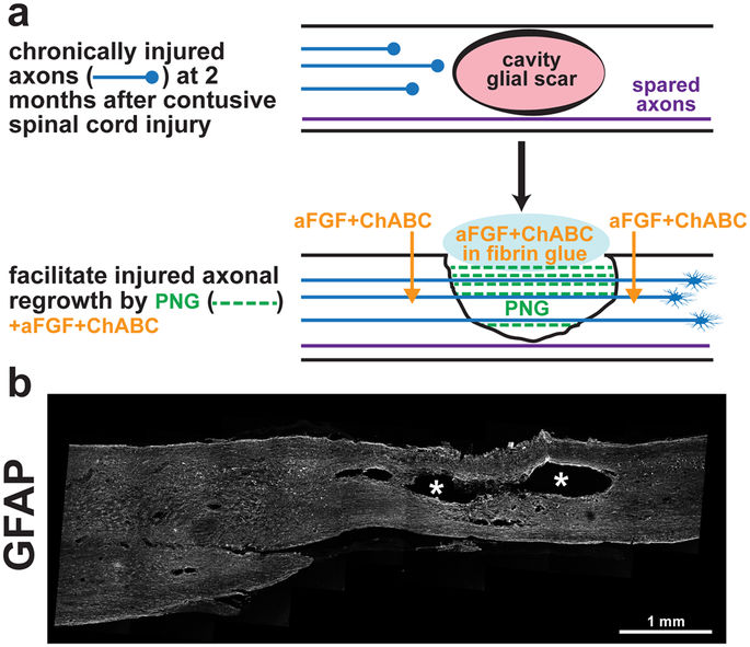 慢性脊髓损伤后促进轴突再生和功能恢复的组合修复策略。,Scientific Reports - X-MOL