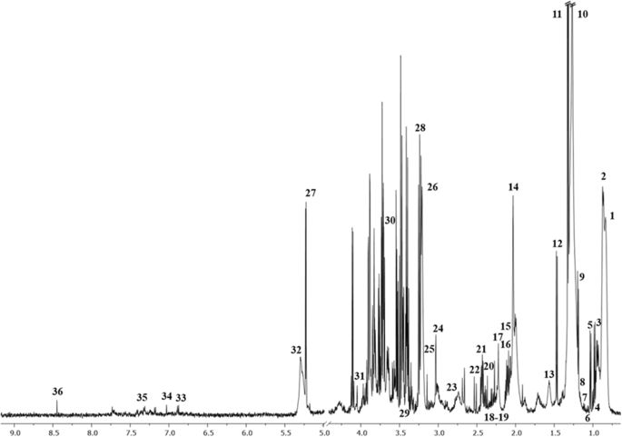 血清和尿液基于1H NMR的代谢组学在某些甲状腺疾病的诊断中。,Scientific Reports - X-MOL