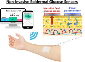 Wearable non-invasive epidermal glucose sensors: A review,Talanta - X-MOL
