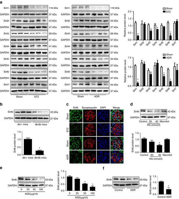 Sirt6 deficiency exacerbates podocyte injury and proteinuria through ... Sirt6 deficiency exacerbates podocyte injury and proteinuria through ...