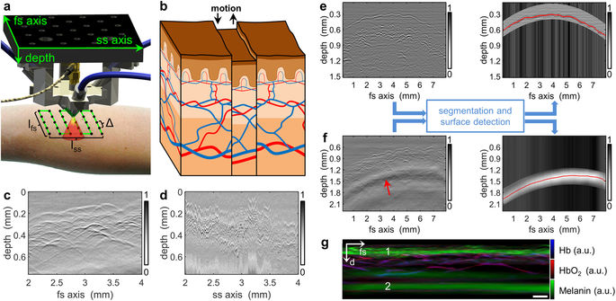 Motion correction in optoacoustic mesoscopy.,Scientific Reports - X-MOL