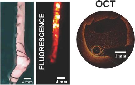 Quantum Dots Emitting in the Third Biological Window as Bimodal ...