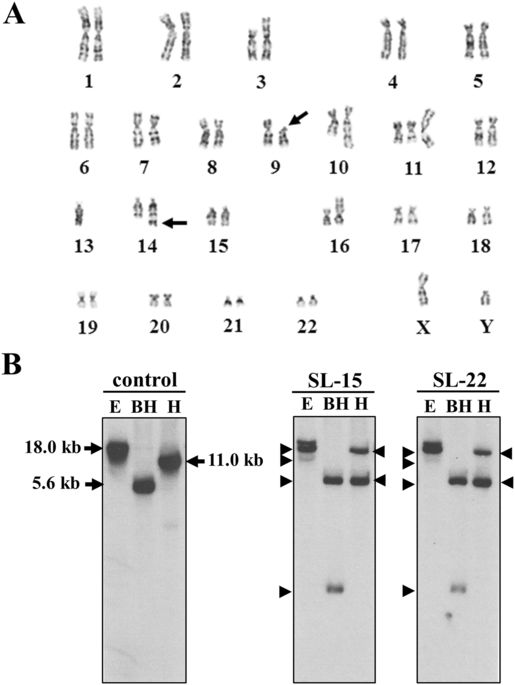 Differential gene expression profiling linked to tumor progression of ...