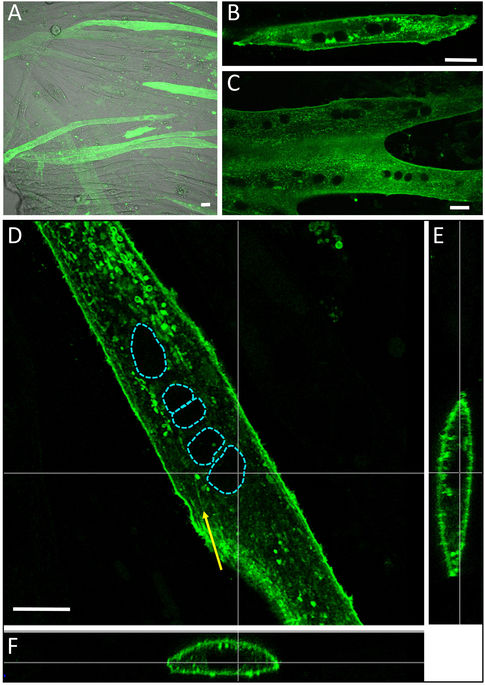 Optogenetic approach for targeted activation of global calcium ...