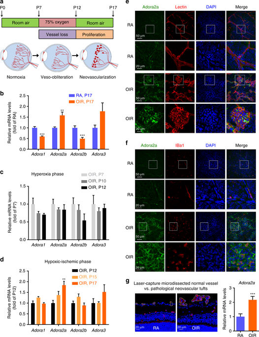 Endothelial adenosine A2a receptor-mediated glycolysis is essential for pathological retinal ...