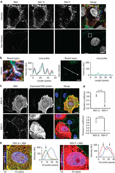 RSV glycoprotein and genomic RNA dynamics reveal filament assembly ...