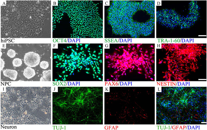 从iPSC衍生的神经元根据形态，生理学和整体基因表达模式对神经分化模型进行特征分析。,Scientific Reports - X-MOL