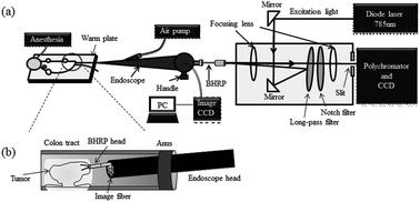 Raman endoscopy for monitoring the anticancer drug treatment of ...