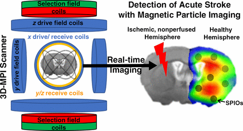 Magnetic Particle Imaging for Real-Time Perfusion Imaging in Acute ...