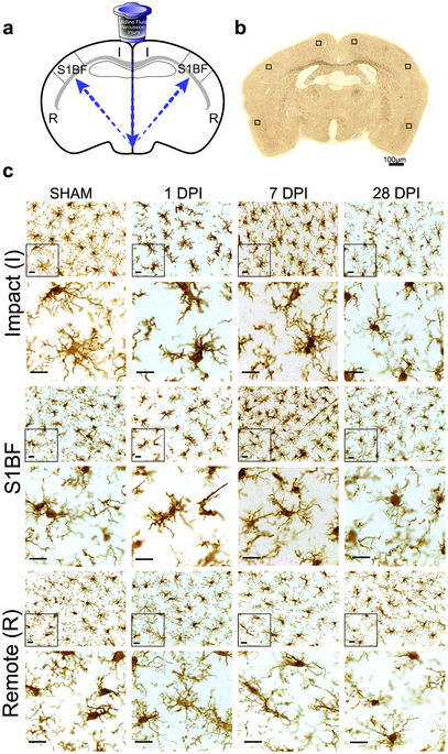 Quantitative microglia analyses reveal diverse morphologic responses in ...