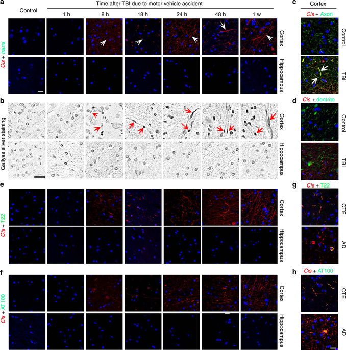 Cis P tau Is Induced In Clinical And Preclinical Brain Injury And