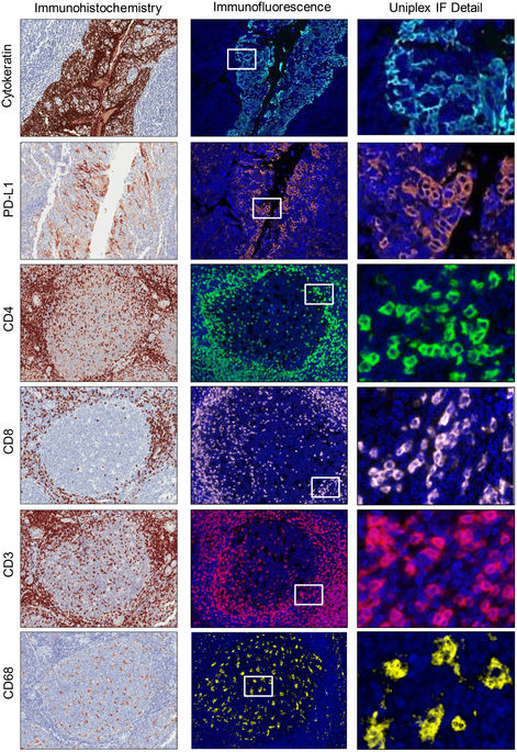 Validation of multiplex immunofluorescence panels using multispectral microscopy for immune ...