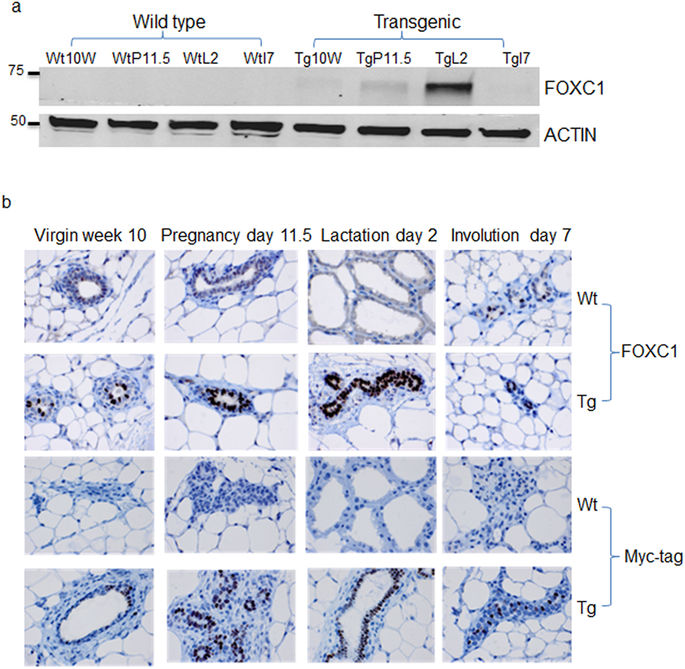 FOXC1过度表达在小鼠乳腺中抑制肺泡的发展。,Scientific Reports - X-MOL