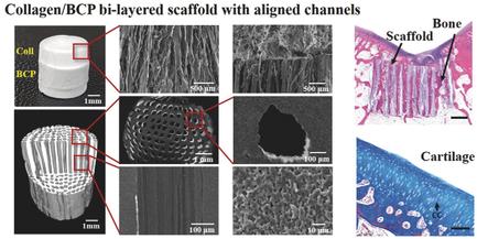 Calcium Phosphate–Collagen Scaffold with Aligned Pore Channels for ...
