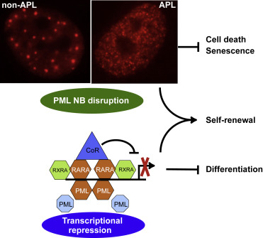 Acute Promyelocytic Leukemia: A Paradigm for Oncoprotein-Targeted Cure ...