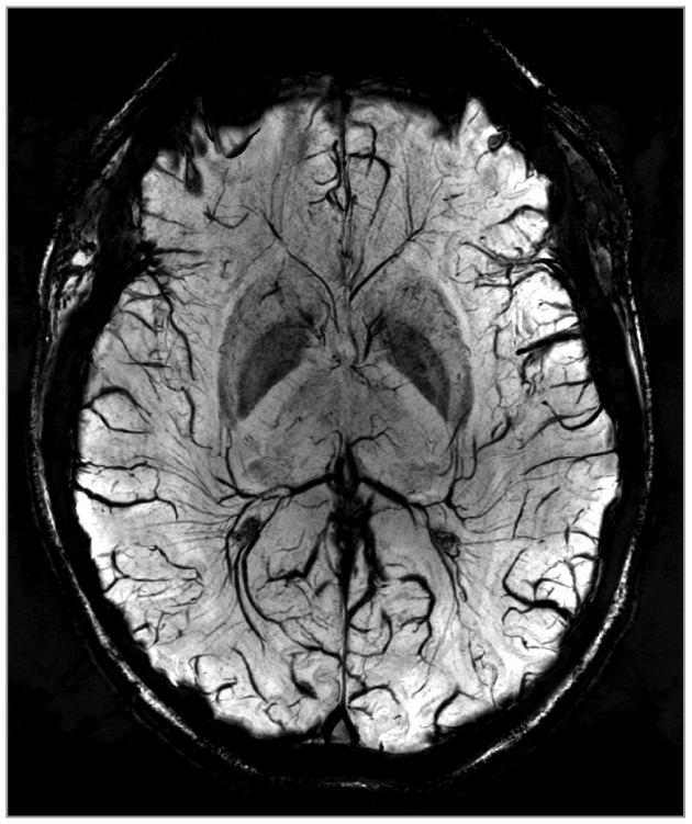 新型MRI的能力翻倍,JAMA - X-MOL