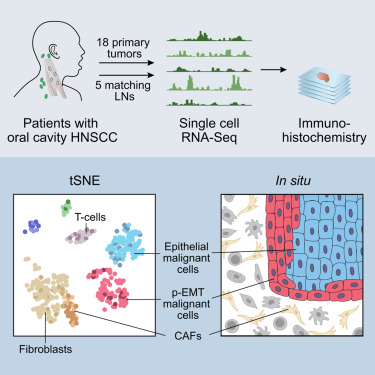 Single-Cell Transcriptomic Analysis of Primary and Metastatic Tumor ...