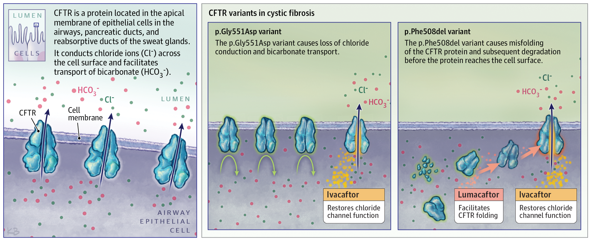 Treating Specific Variants Causing Cystic Fibrosis,JAMA - X-MOL