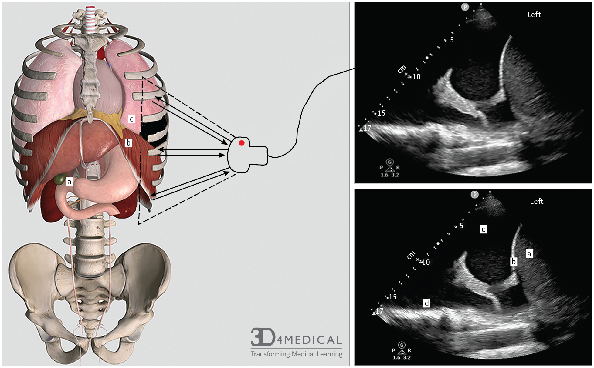 The Practice and Implications of Finding Fluid During Point-of-Care ...
