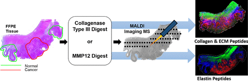 Mapping Extracellular Matrix Proteins in Formalin-Fixed, Paraffin-Embedded Tissues by MALDI ...