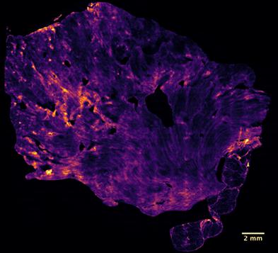 Partial nephrectomy margin imaging using structured illumination ...