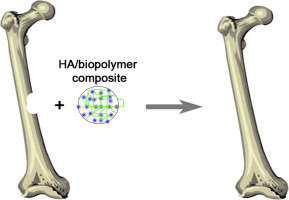 Synthesis of hydroxyapatite for biomedical applications,Advances in ...