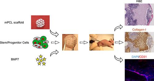 Fetal Bone Marrow-Derived Mesenchymal Stem/Stromal Cells Enhance Humanization and Bone Formation ...