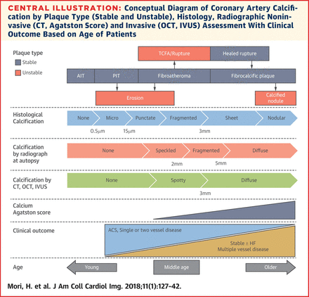 Coronary Artery Calcification and its Progression What Does it Really ...