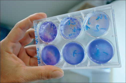 Ban on gain-of-function studies ends,The Lancet Infectious Diseases - X-MOL